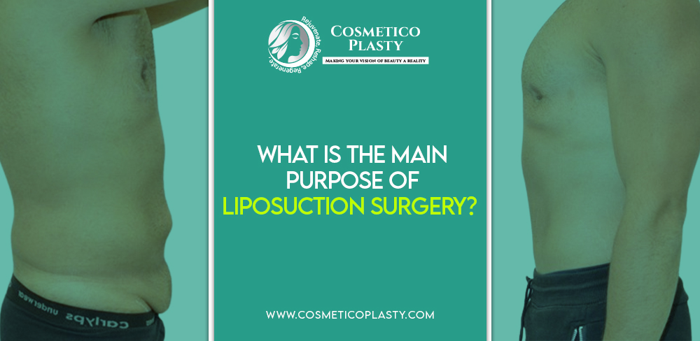 Breast capsular contracture, its causes, symptoms, and treatment